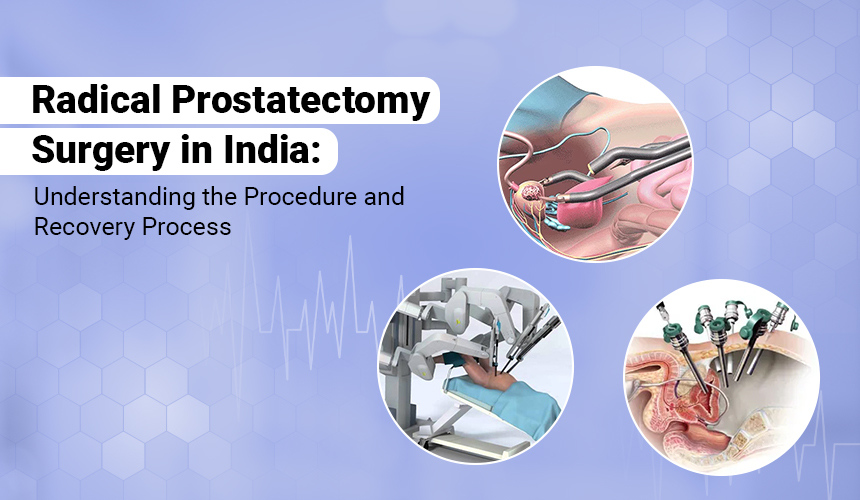 Radical Prostatectomy Surgery In India World Of Urology Radical Prostatectomy Surgery In India World Of Urology